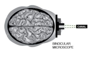 Vorotek O Scope - Alsoka Medical